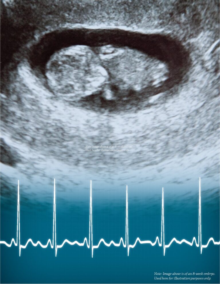 The Fetal Heartbeat – Life International Academy